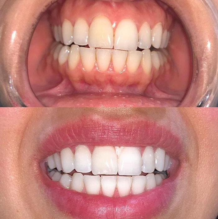 Services | Timberline Nails & Spa of Fort Collins, CO 80525 | Gel ...